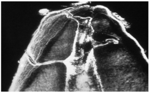 PATÊNCIA APICAL: FATO OU FICÇÃO – UM MITO OU UMA REALIDADE? UMA ...